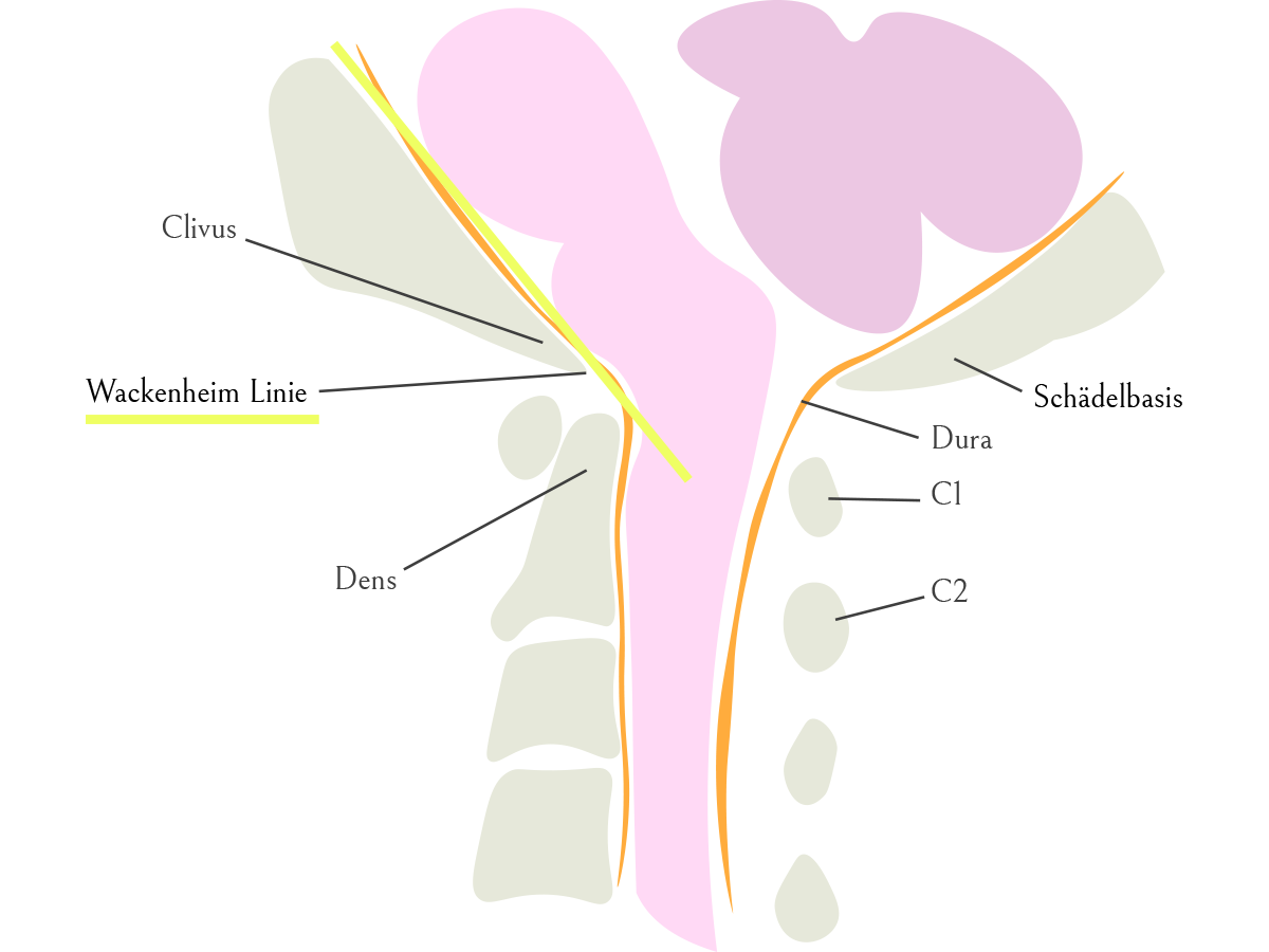 Wichtige Maße zur Beurteilung einer CCI/AAI - wirbelwirrwarr